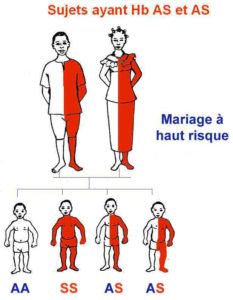 La drepanocytose Traitement Syndromes Crise Causes | Drepa31 Toulouse