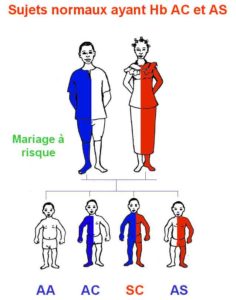 La drepanocytose Traitement Syndromes Crise Causes | Maladie rare